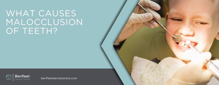 Malocclusion of Teeth - Explained | Benfleet Dental Centre