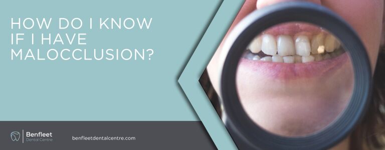 Malocclusion of Teeth - Explained | Benfleet Dental Centre